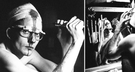 This author drilled a hole in his head to stay permanently high